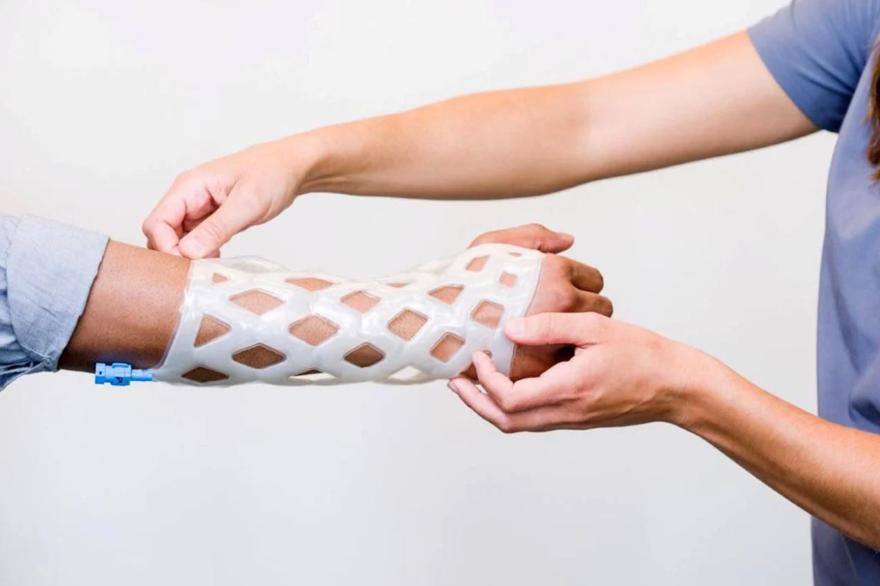 Reinventing Fracture Casts – BE OPEN BLOG